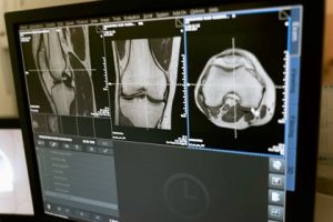 Dangers of Being a Radiology Technician - RadiologyED.org